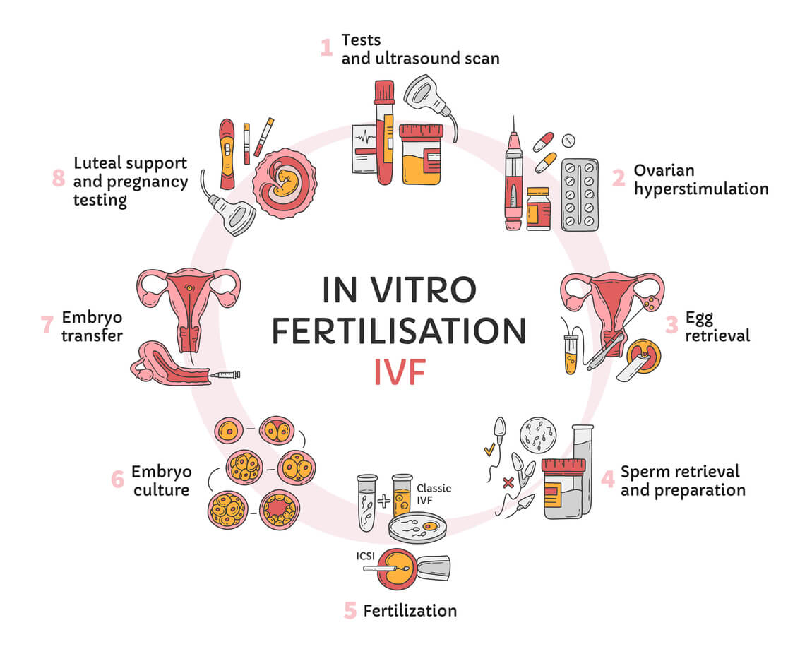 IVF Surrogacy: How Does IVF And Surrogacy Work Together?